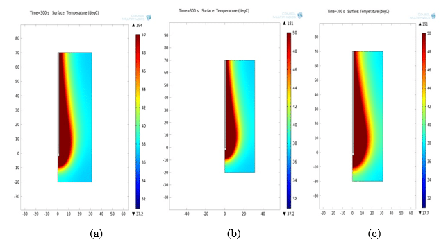 Optimal Antenna Design for Microwave Ablation of Breast Cancer: A ...