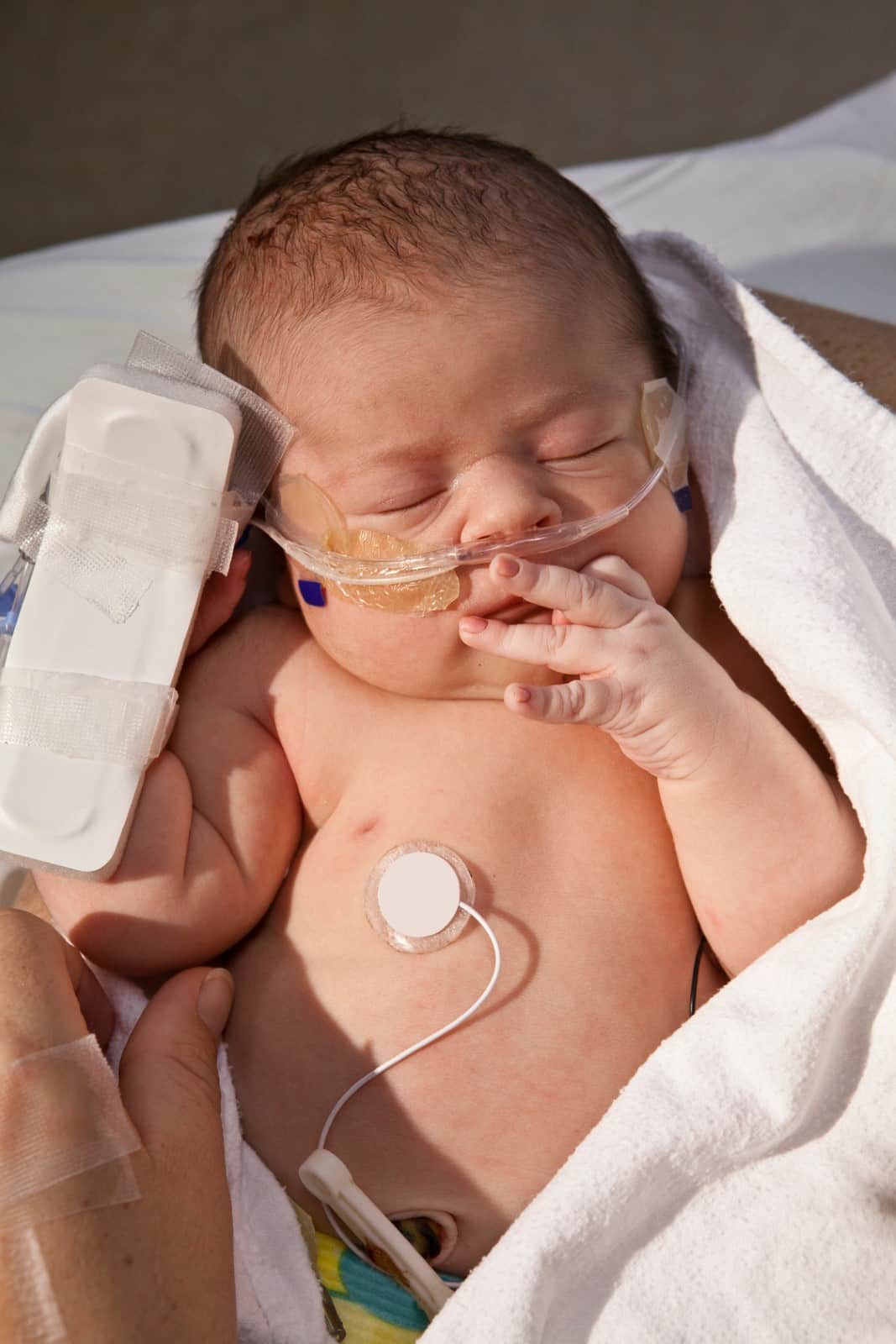 Birth Asphyxia: Prevalence, Outcomes & Determinants in Newborns ...