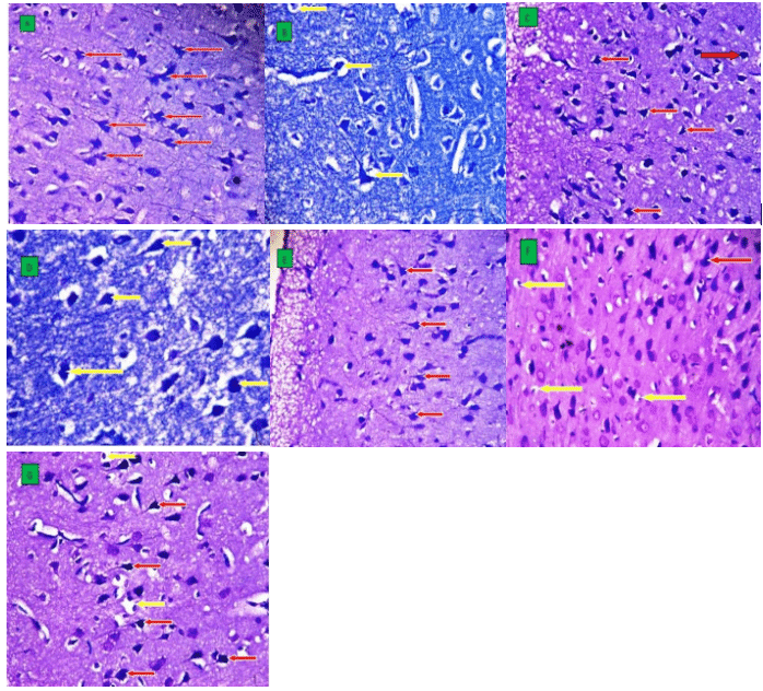 Watermelon Seeds: A Natural Shield Against Brain Damage - medtigo Journal
