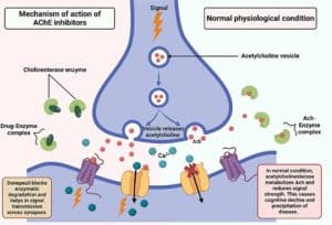 Emerging Therapies in Alzheimer’s Treatment - medtigo Journal