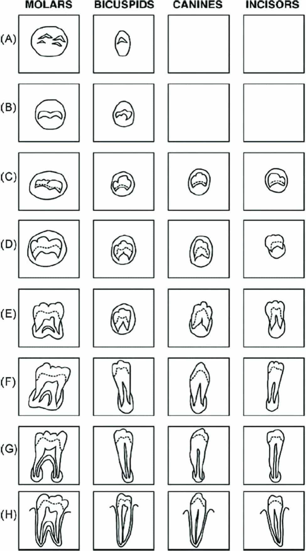Assessment of Age Using Orthopantomography and AI - medtigo Journal